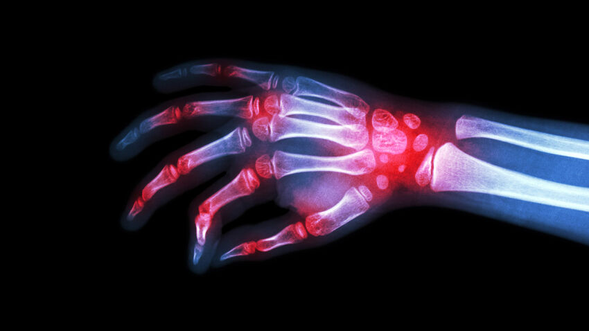 Manage Your Aching Bones | theTrumpet.com